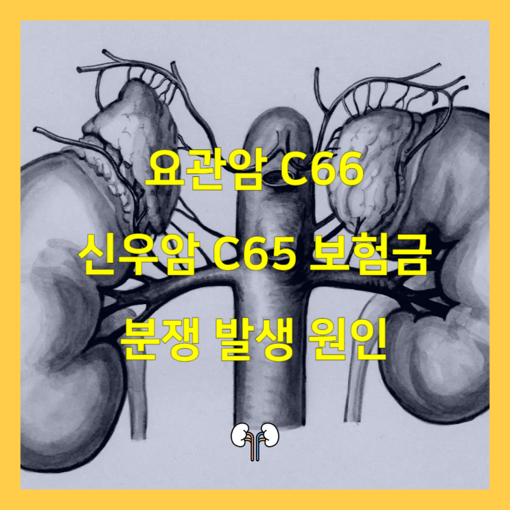 요관암 C66 신우암 C65 보험금 분쟁 발생 원인 : 네이버 블로그