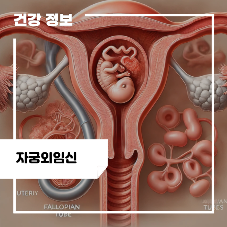 자궁외임신 초기증상 및 원인 치료 방법 자궁외임신 무증상 네이버 블로그