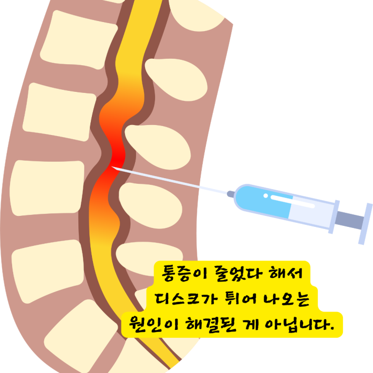 센텀한의원 허리디스크 수술 없이 회복하는 치료 원칙 1가지 네이버 블로그