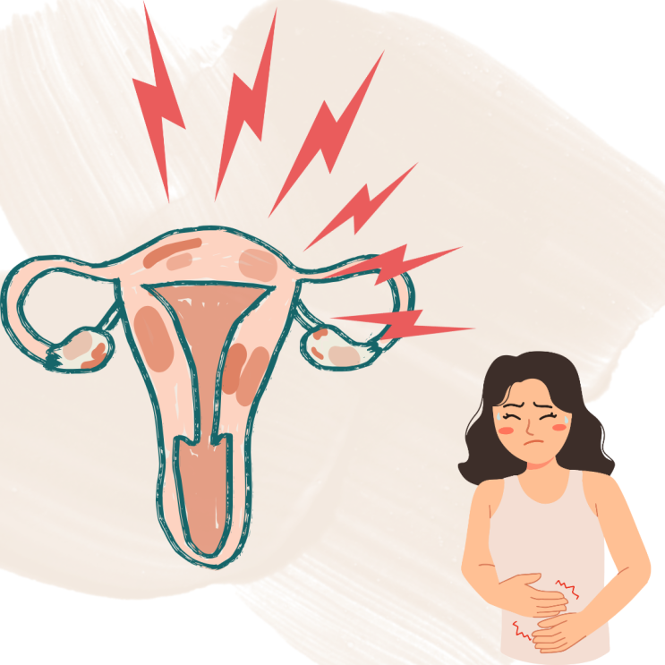 착상통 증상 임신 초기의 자연스러운 현상들 : 네이버 블로그