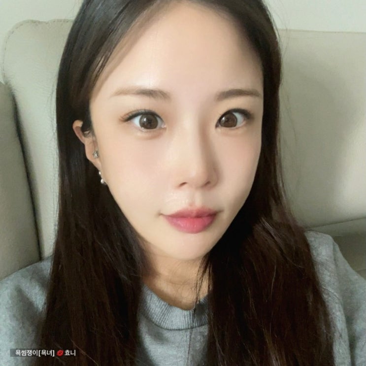 청담 피부과 티타늄 리프팅 효과 유지기간 부작용 후기 네이버 블로그