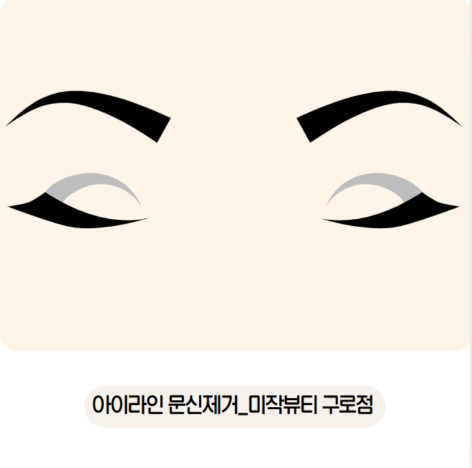 구로 여의도 미작 뷰티 구로점 아이라인 문신 제거 후기 네이버 블로그