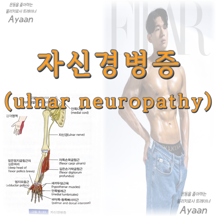 [신경계 중재학] 자신경병증(ulnar neuorpathy)이란? / 갈퀴손(clow hand) / 프로멘트 징후 / 자굴 ...