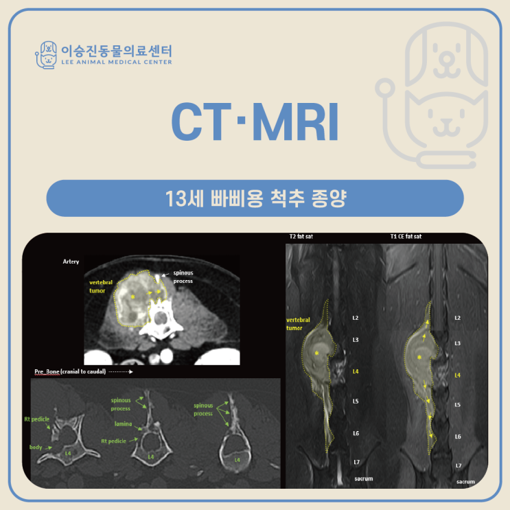 Ctmri를 통한 척추 종양의 진단 네이버 블로그