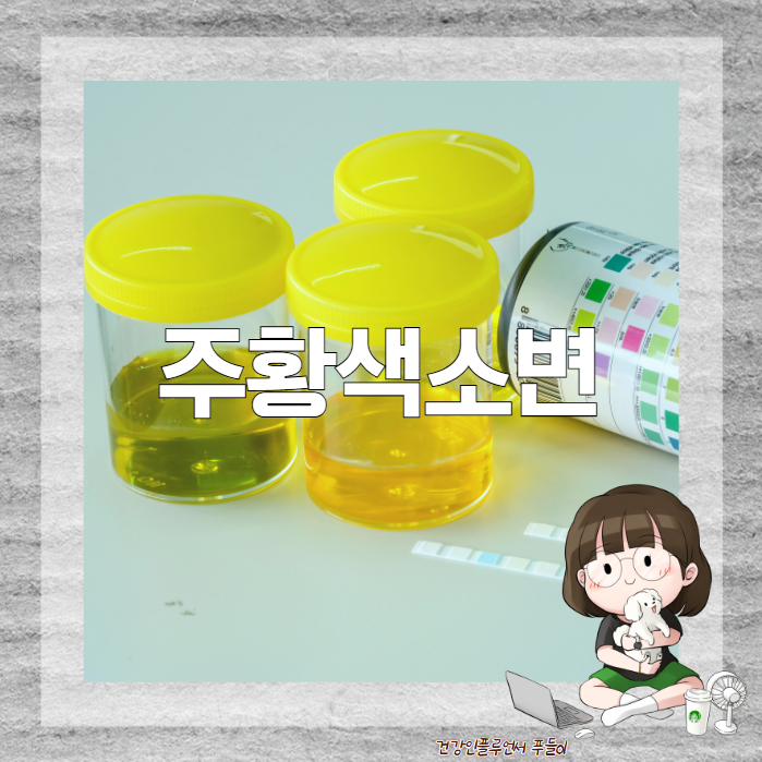 주황색소변 초록색 갈색 노란소변 붉은색 소변색깔 따른 건강상태 네이버 블로그
