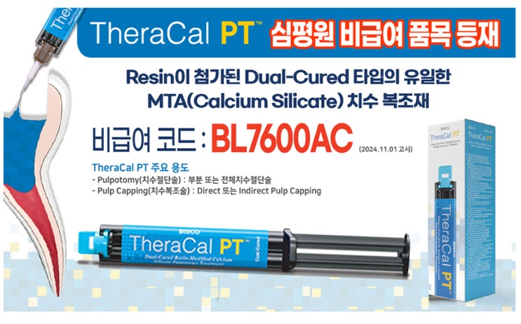 TheraCal PT, MTA 치수 복조재, pulpotomy, pulp capping, Theracal PT 심평원 비급여 ...