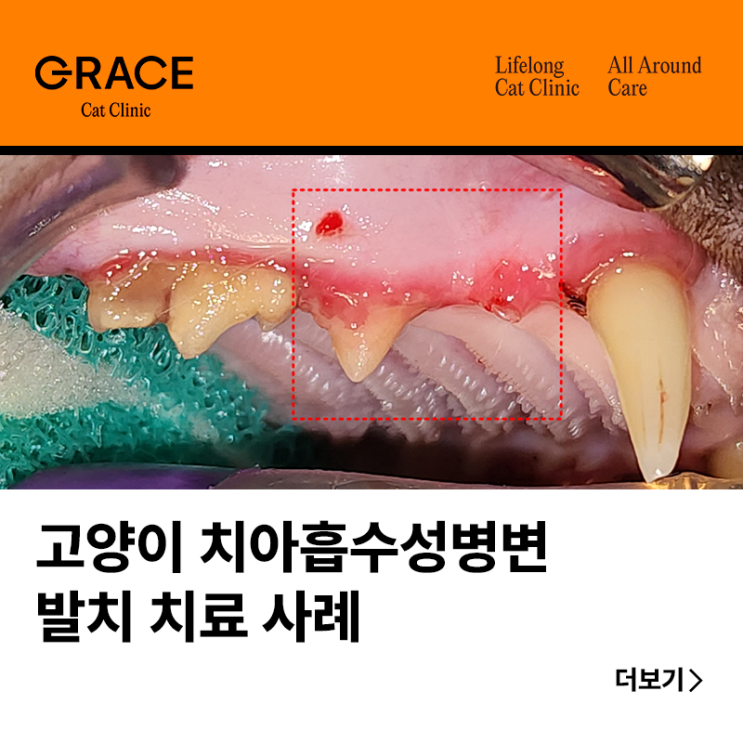 노령 고양이 치아흡수성병변(FORL)으로 인한, 발치 치료 사례 : 네이버 블로그