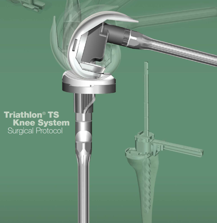 Knee- Revisional TKRA (Stryker TS revision) 무릎인공관절 재치환술 스트라이커 TS : 네이버 블로그