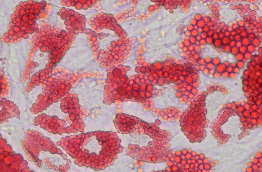 [실험 정보] Oil red O staining (ORO staining) : 네이버 블로그