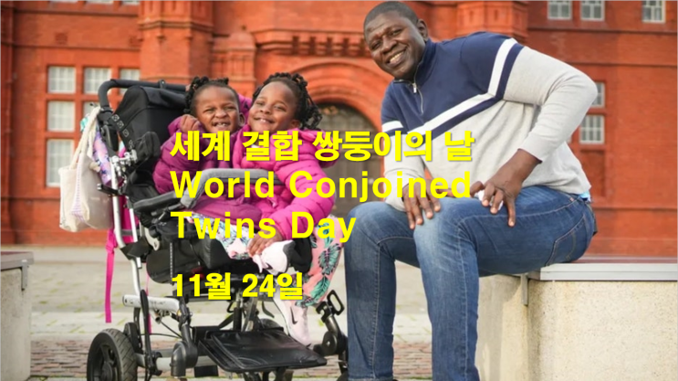 국제기념일, UN 세계 결합 쌍둥이의 날 World Conjoined Twins Day, 11월 24일 : 네이버 블로그