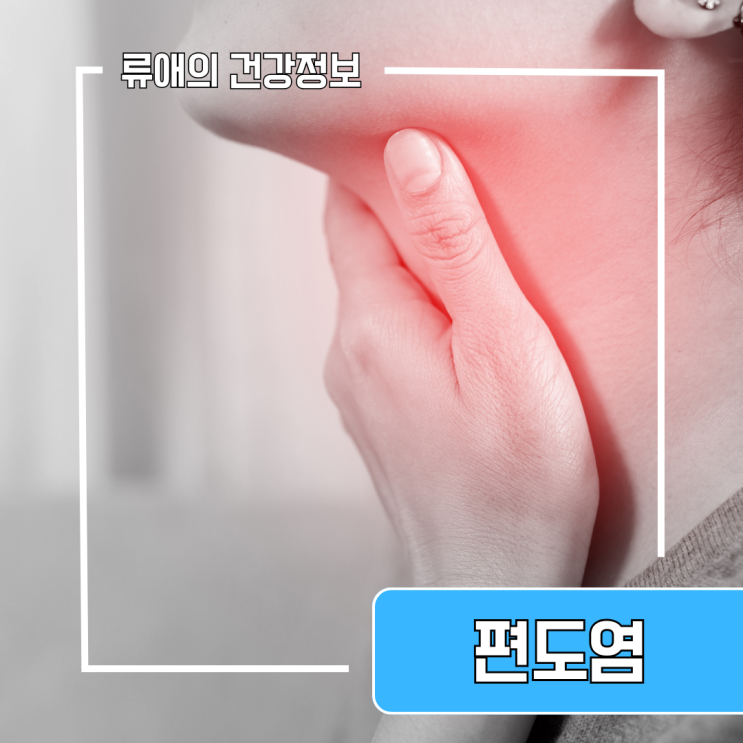 급성 편도염 염증 이유 편도염 증상 원인 치료 정보 네이버 블로그