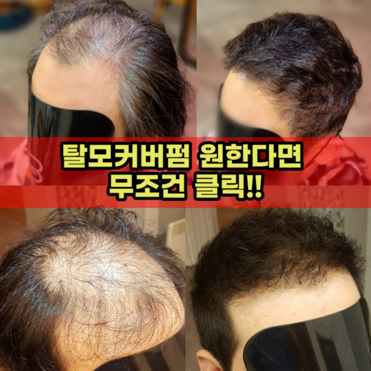 남자 탈모 커버 펌 유의사항 탈모 펌 가능한 머리 길이 인천 탈모 머리 펌 남자 소프트 스핀 스왈로 펌 탈모 헤어스타일