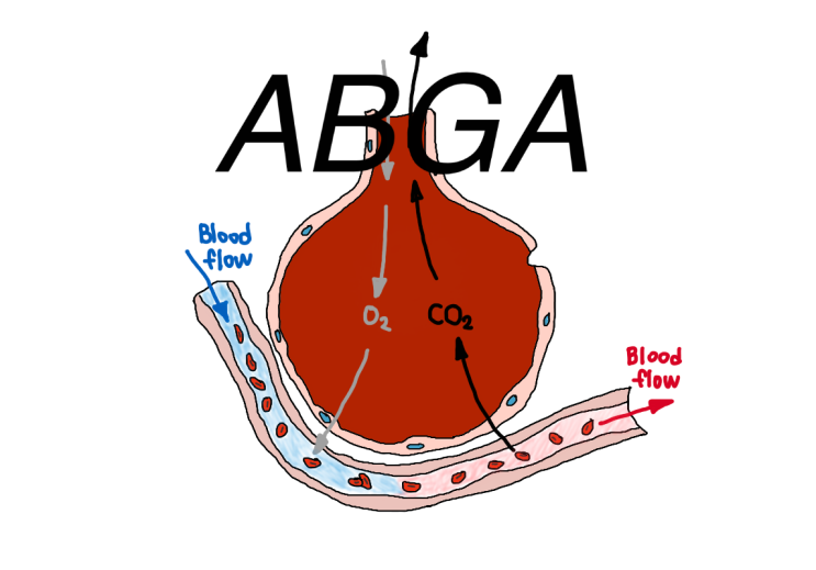 ICU에서 일하다:)ABGA 검사방법 및 Allen test : 네이버 블로그