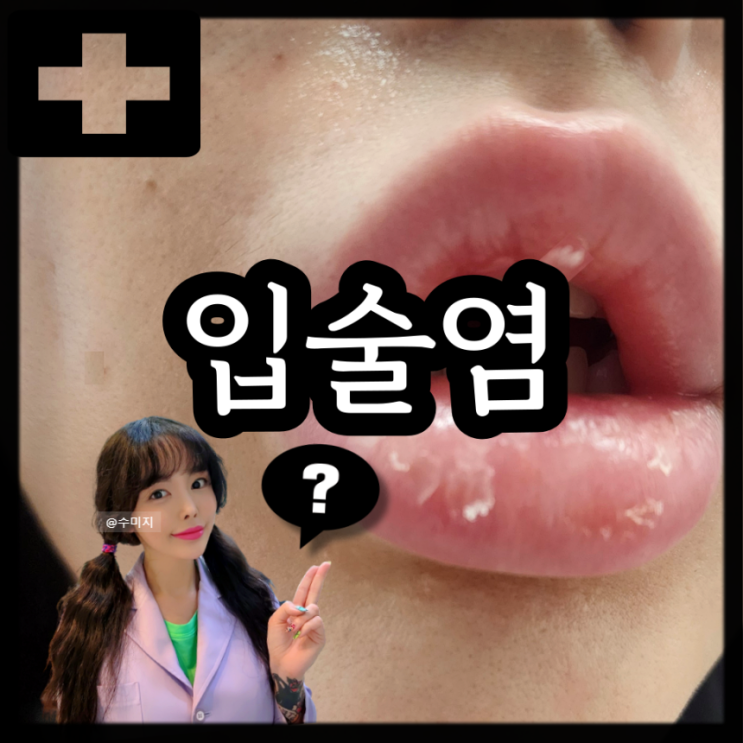 탈락성 입술염 구각염 증상 입술 찢어졌을때 입 옆 찢어짐 구각염 연고 네이버 블로그