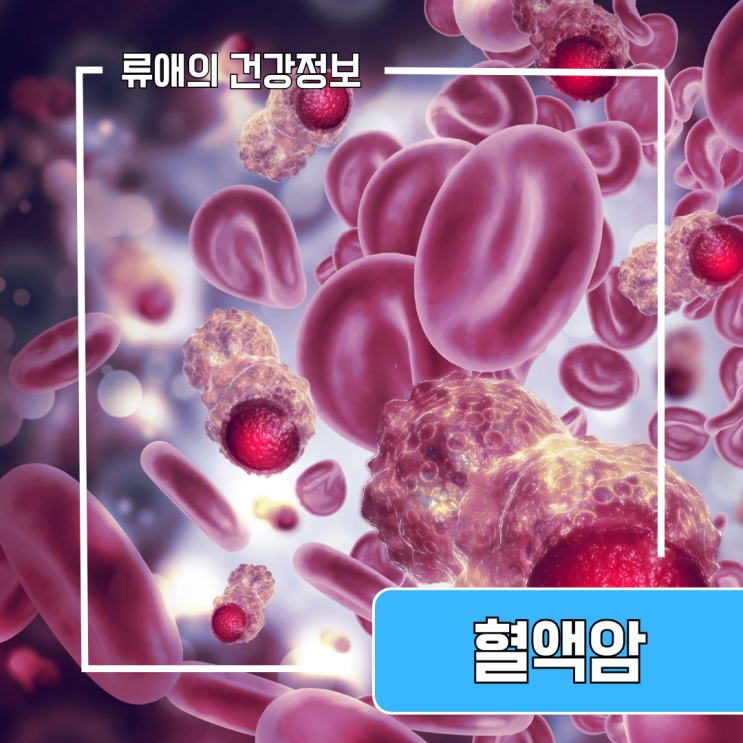 혈액암초기증상 피부 멍 반점 징후 림프종혈액암증상 및 완치율 네이버 블로그