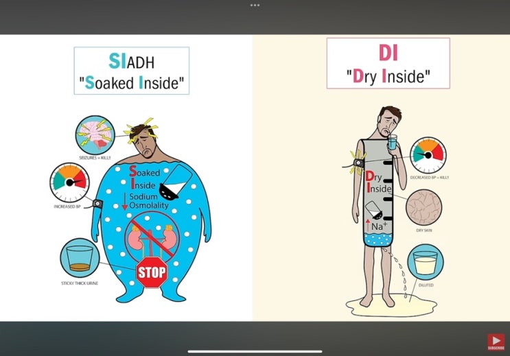 SIADH vs 의학용어 DI(Diabetes Insipidus) 요붕증 비교 공부하기 : 네이버 블로그