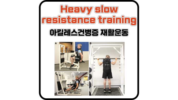 아킬레스건병증 재활 운동 고강도 느린 저항 운동(Heavy slow resistance training) : 네이버 블로그