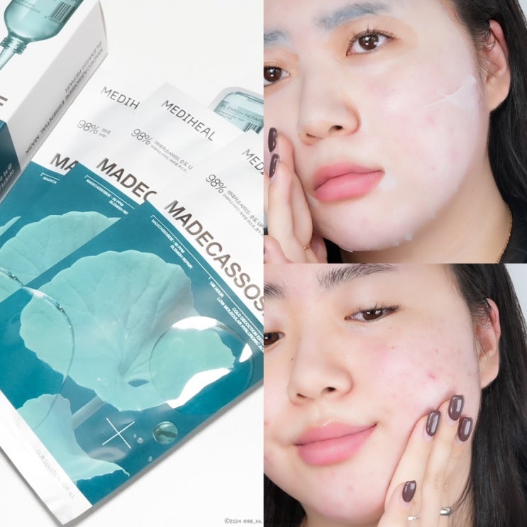 올리브영 마스크팩 추천 더욱 강력해진 메디힐 마데카소사이드 마스크팩 네이버 블로그
