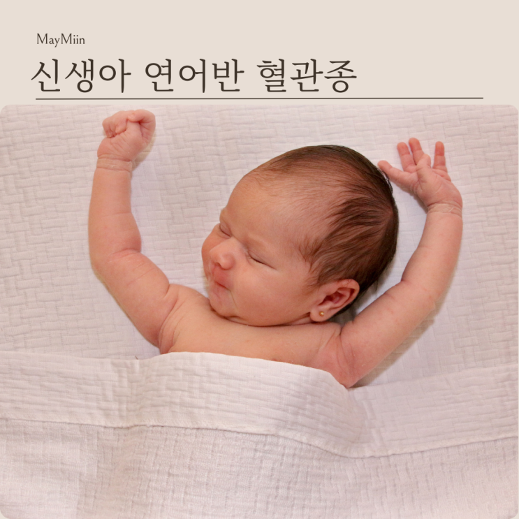 신생아 연어반 치료 아기 딸기 혈관종 원인 증상 네이버 블로그