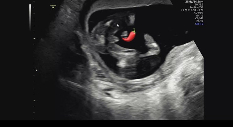 임신일기 14 16주차 성별공개 뱀띠아들맘 확정🌶️ 피곤함 입덧완화 2차기형아검사 젠더리빌 네이버 블로그