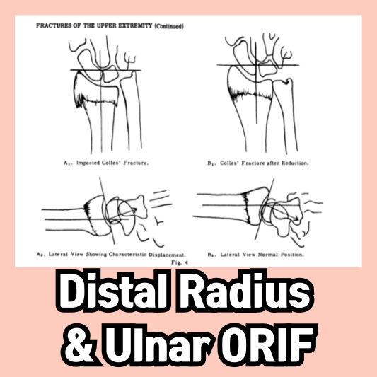 distal Radius & ulnar ORIF 손목골절 수술(OS3) : 네이버 블로그