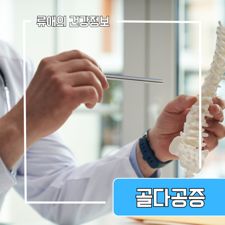 골다공증 증상 및 원인 치료 골다공증 수치 검사 약 골밀도정상수치 네이버 블로그