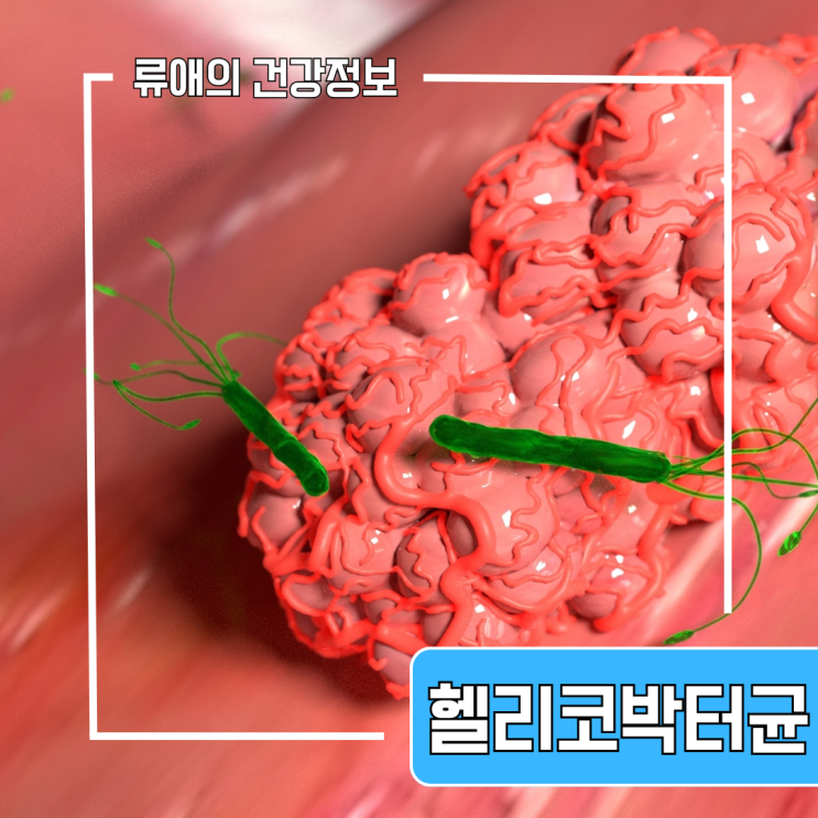 헬리코박터균 속쓰림 증상 원인 치료 헬리코박터균 가족 전염 약 네이버 블로그