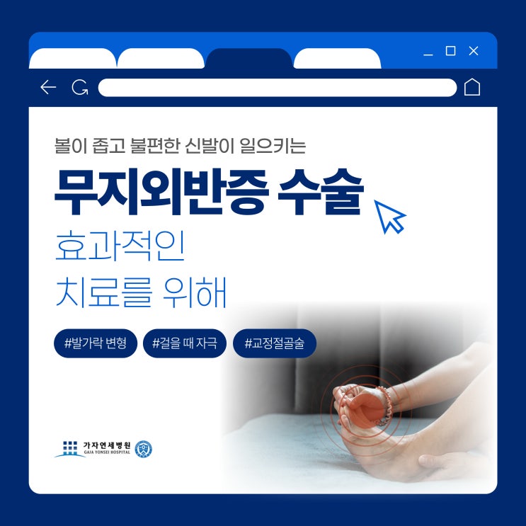 무지외반증 수술, 증상에 맞는 치료로 개선을 : 네이버 블로그