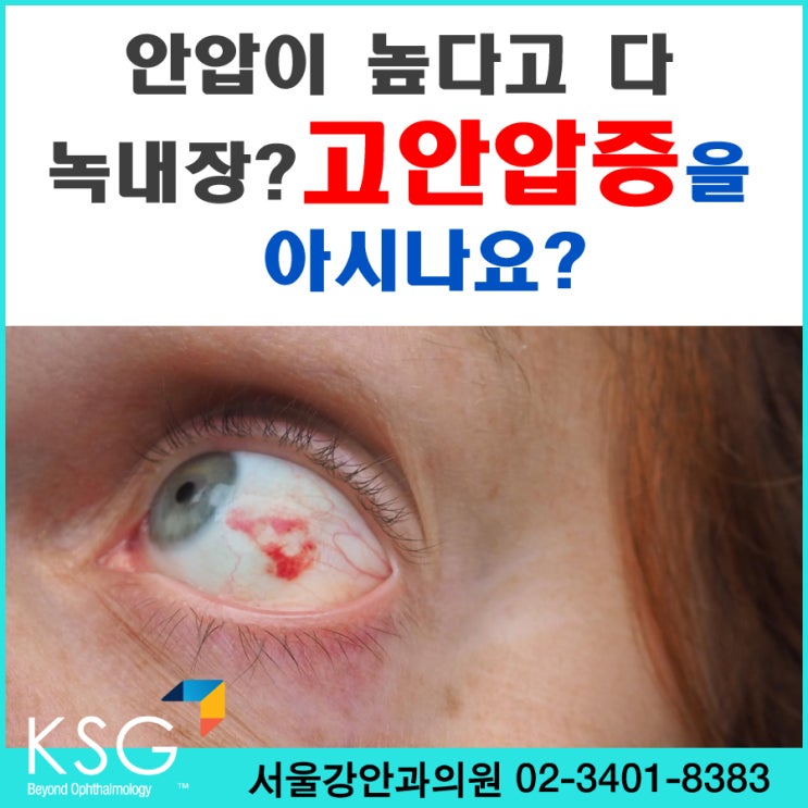 안압이 높다고 다 녹내장? “고안압증”을 아시나요? : 네이버 블로그