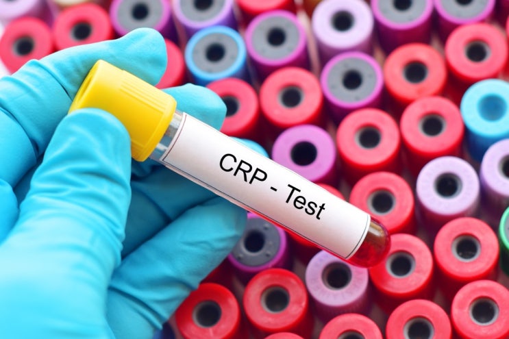 CRP 염증 반응 수치(C-Reactive Protein Blood Test) : 네이버 블로그