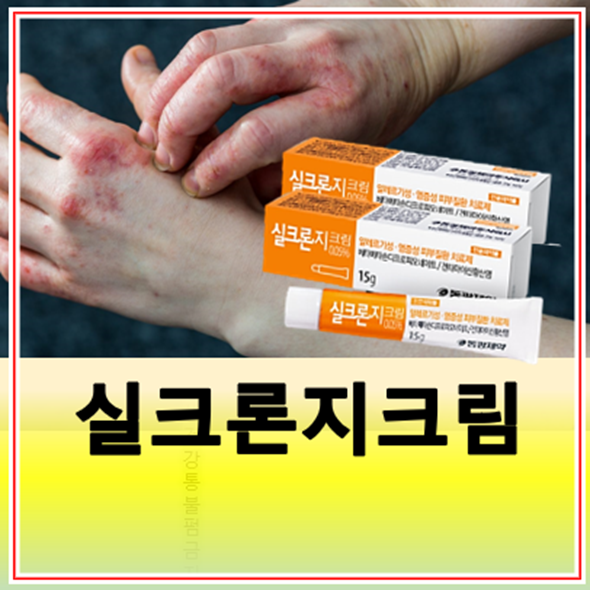 실크론지크림 성분 효과 부작용 가격 스테로이드 연고 네이버 블로그