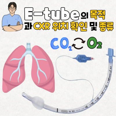 E-tube Endotracheal tube 삽입 원인과 종류와 Chest X-ray 위치 확인하는 방법 : 네이버 블로그