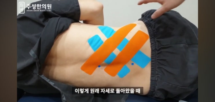 옆구리(flanks) 아플 때 테이핑 . 요방형근 (Lower back pain QL area Kinesio Taping ...