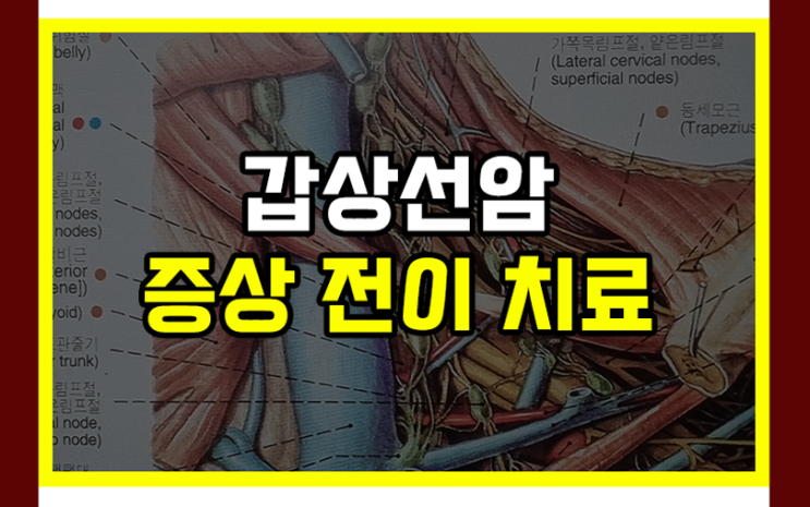 갑상선암 수술 후기 속 증상 전이 치료 내용 정리 : 네이버 블로그