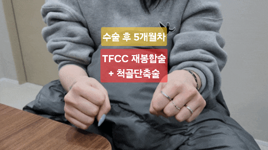 [손목클리닉] 삼각섬유연골복합체(TFCC) 2번의 손목 관절경 봉합 수술 후 지속된 손목 통증 : 관절경 재봉합술 및 척골 ...