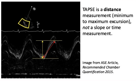 심초음파를 이용한 우심실 기능 평가 (RV basal dimension, RVOT prox dimension, RVFAC ...