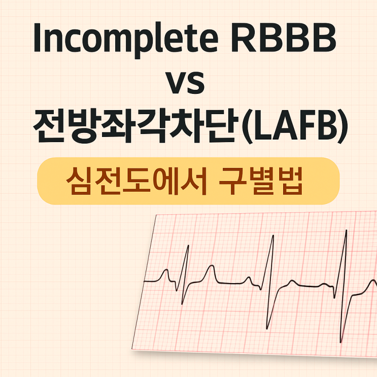 Incomplete RBBB vs 전방좌각차단(LAFB) : 네이버 블로그