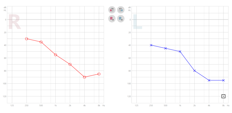 시그니아 최신상 퓨어 BCT 7IX 착용사례 : 네이버 블로그