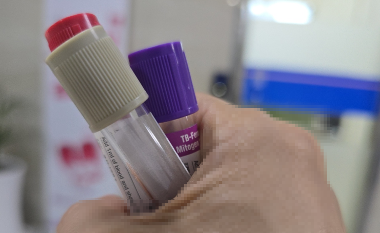 역학조사로 보건소에서 받은 결핵검사 : 네이버 블로그