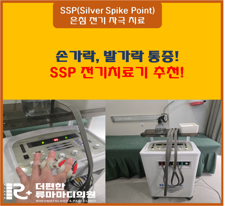손가락 관절통, 발가락 찌릿한 통증… SSP 전기치료기 추천! : 네이버 블로그
