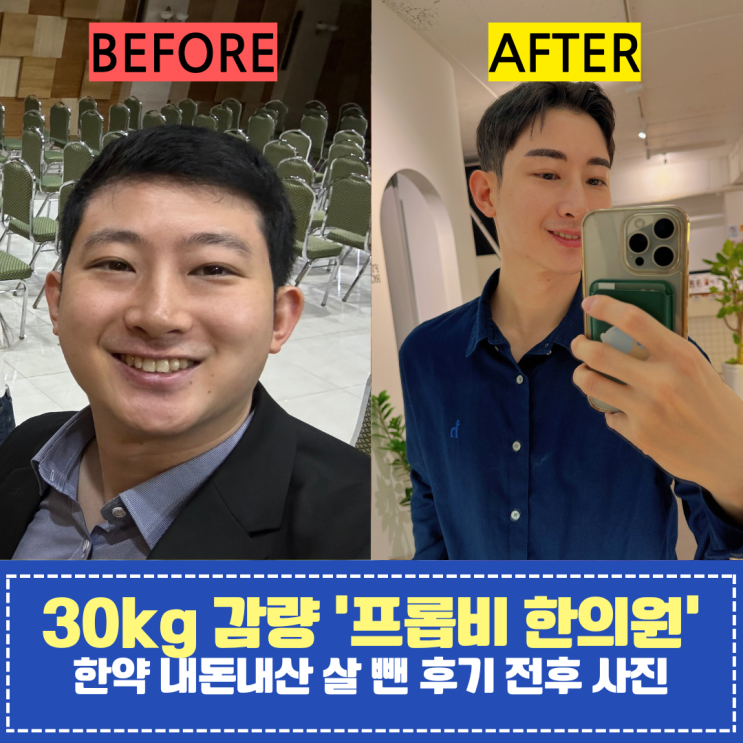 30kg 살 빼는 한약 전후 사진 강남 프롭비한의원 내돈후기 : 네이버 블로그