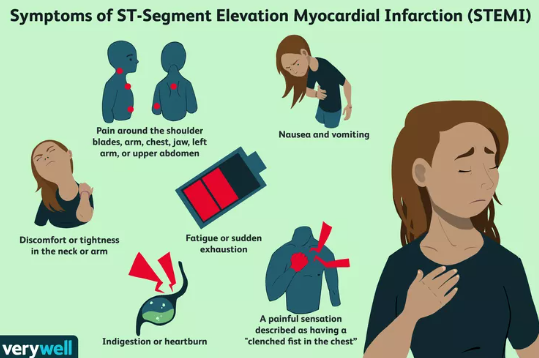 심근경색증(MI)의 STEMI, NSTEMI 차이점과 ekg, lab 정리 : 네이버 블로그