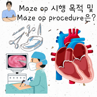 Atrial fibrillation surgery Maze op의 목적 및 시행 이유 그리고 Maze procedure은 ...