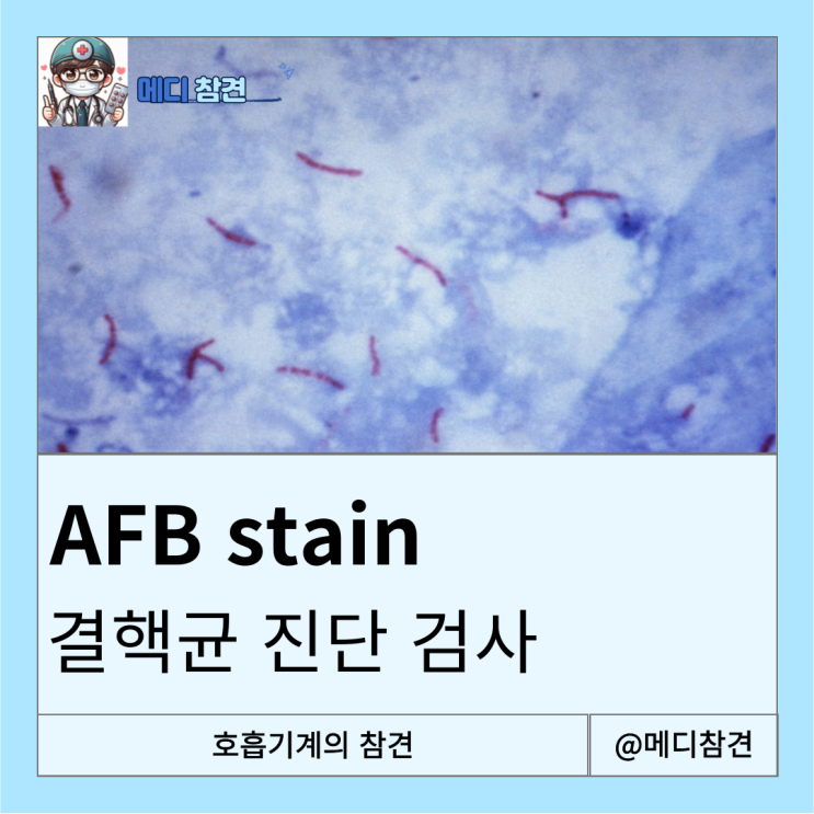 AFB stain test 항산균 도말 검사 의학용어 Tb : 네이버 블로그