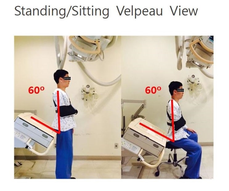 velpeau view : 네이버 블로그