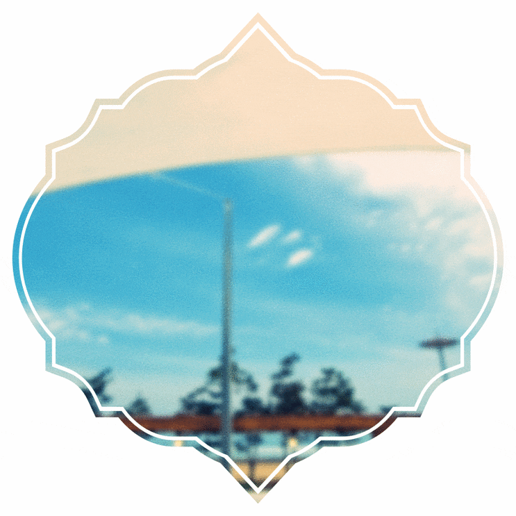 울산 쌍꺼풀수술 자연스러운 라인과 회복 기간 비교 : 네이버 블로그