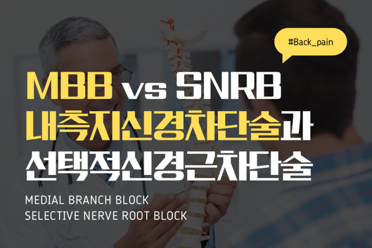 MBB, Medial Branch Block 내측지 신경차단술 vs SNRB, Selective Nerve Root Block ...