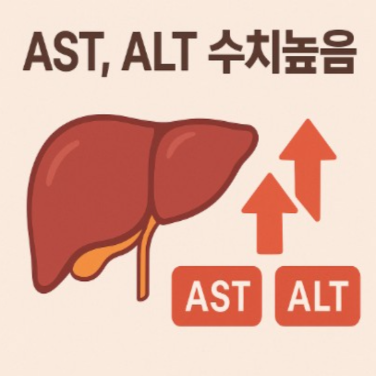 AST, ALT 수치 높음, 언제 병원 가야 할까? : 네이버 블로그
