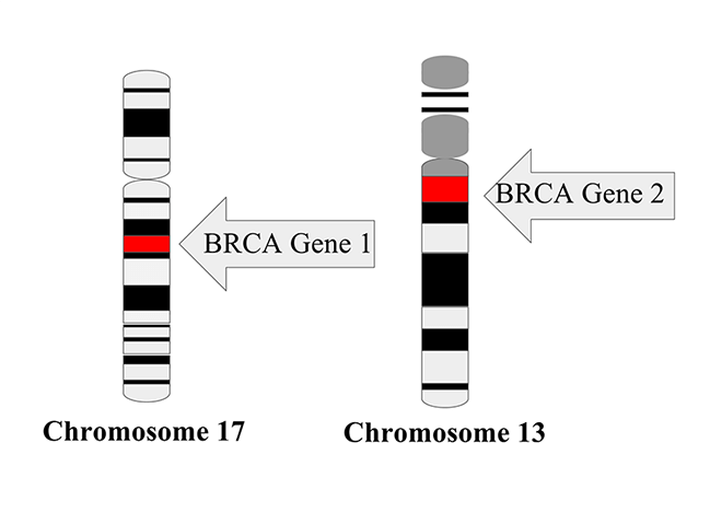 STUDY | 유전성 유방암 BRCA 1 2 브라카 유전자와 검사 대상자 적응증 : 네이버 블로그