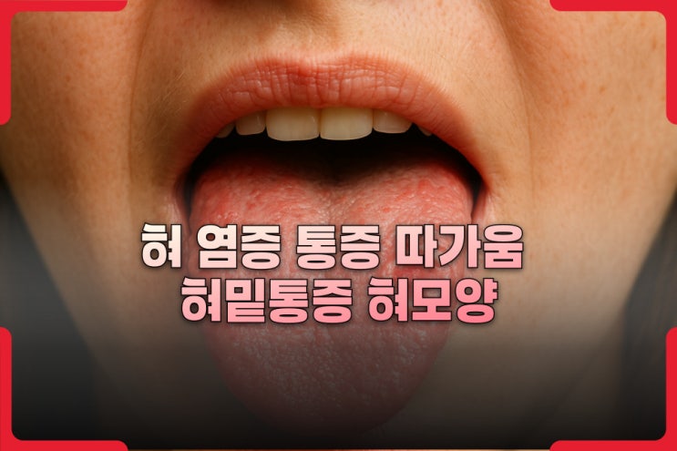 혀 염증 통증 따가움 혀밑통증 인한 혀모양 건강상태 : 네이버 블로그